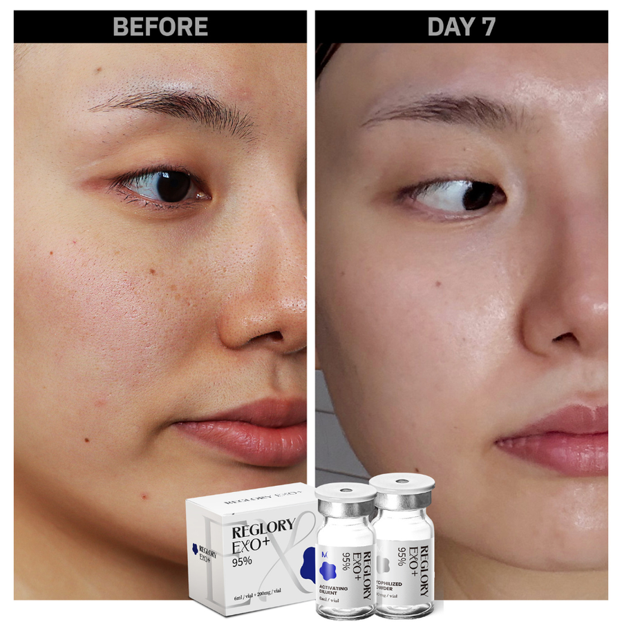 Reglory EXO Exosome Skin Booster – Dr. Pen Australia