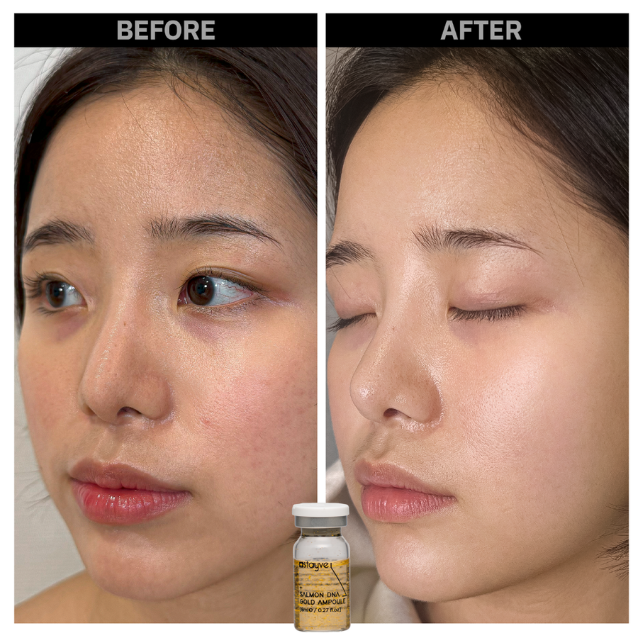 Stayve Booster Starter Kit (Microneedling Ampoule) – Dr. Pen Australia