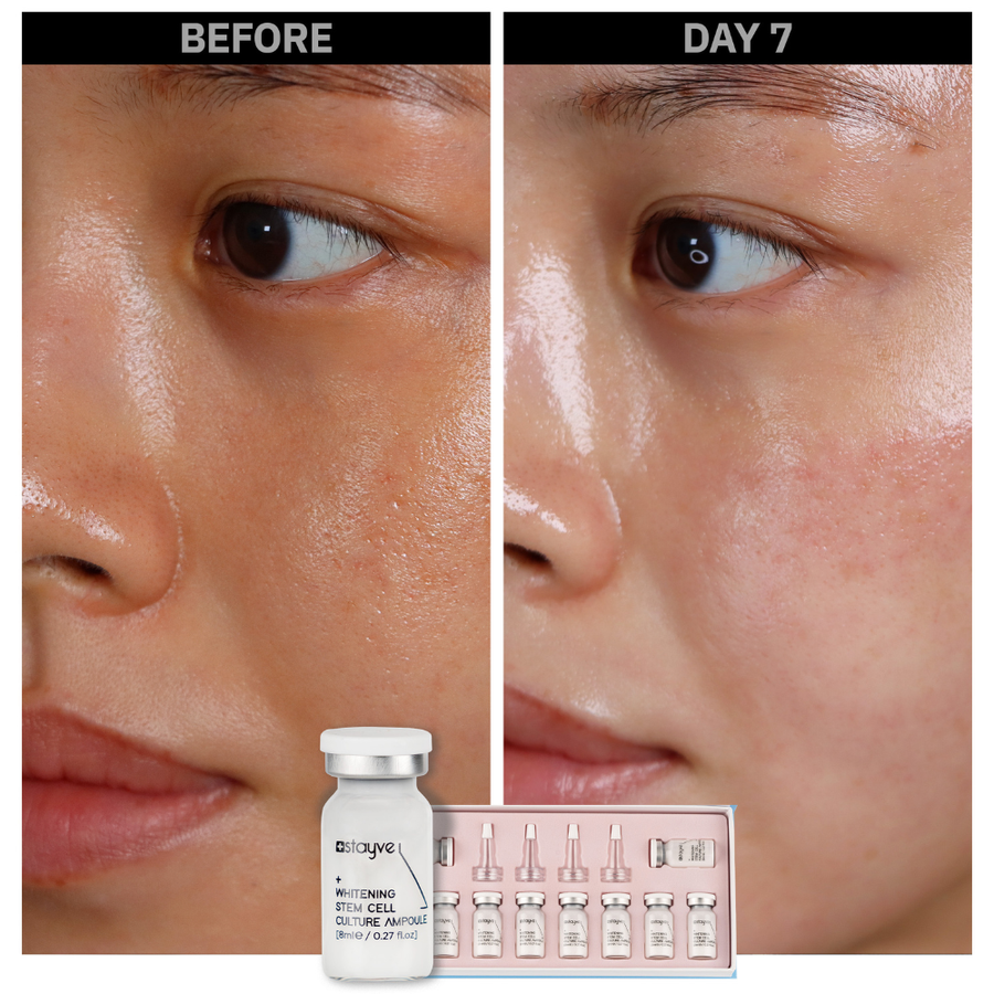 Stayve Booster Starter Kit (Microneedling Ampoule) – Dr. Pen Australia